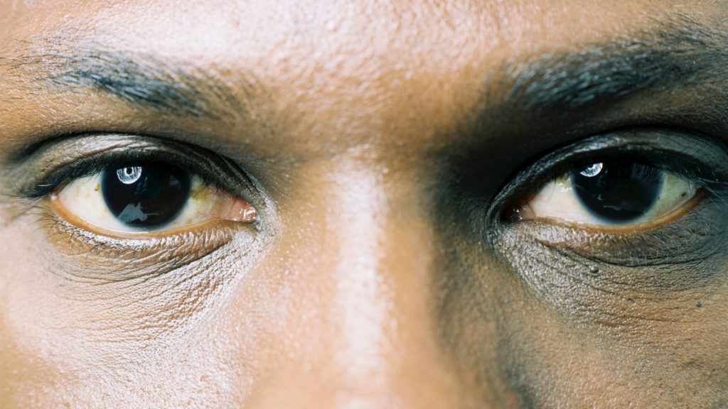 Cannabis Effects on The Eyes: What Science Says
